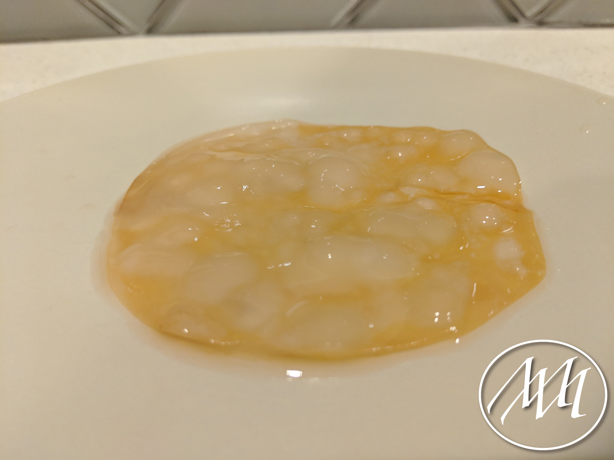 How to Grow Your Own Kombucha SCOBY (Symbiotic Colony of Bacteria and ...